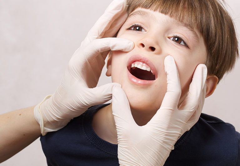 What are the causes of Delayed Dental Development? - Dr Joy Dental Clinic