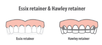 Hawley Retainer- Usage, Process and Benefits - Dr Joy Dental Clinic