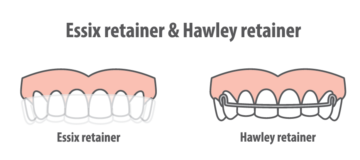 Hawley Retainer- Usage, Process and Benefits - Dr Joy Dental Clinic