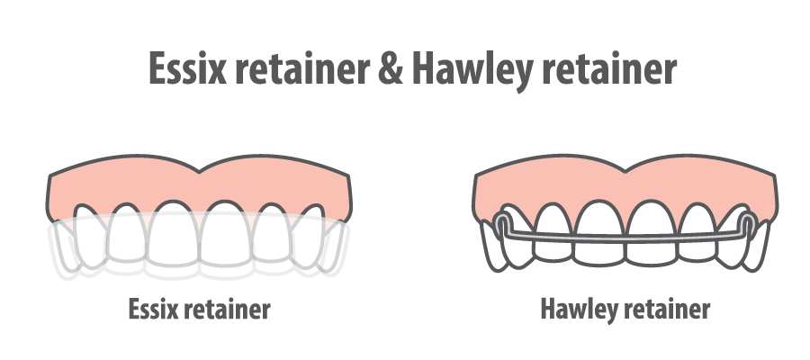 Hawley Retainer- Usage, Process and Benefits - Dr Joy Dental Clinic